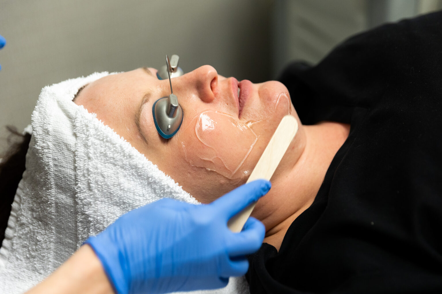 Forever Clear BBL | Kansas City Skin and Cancer Center