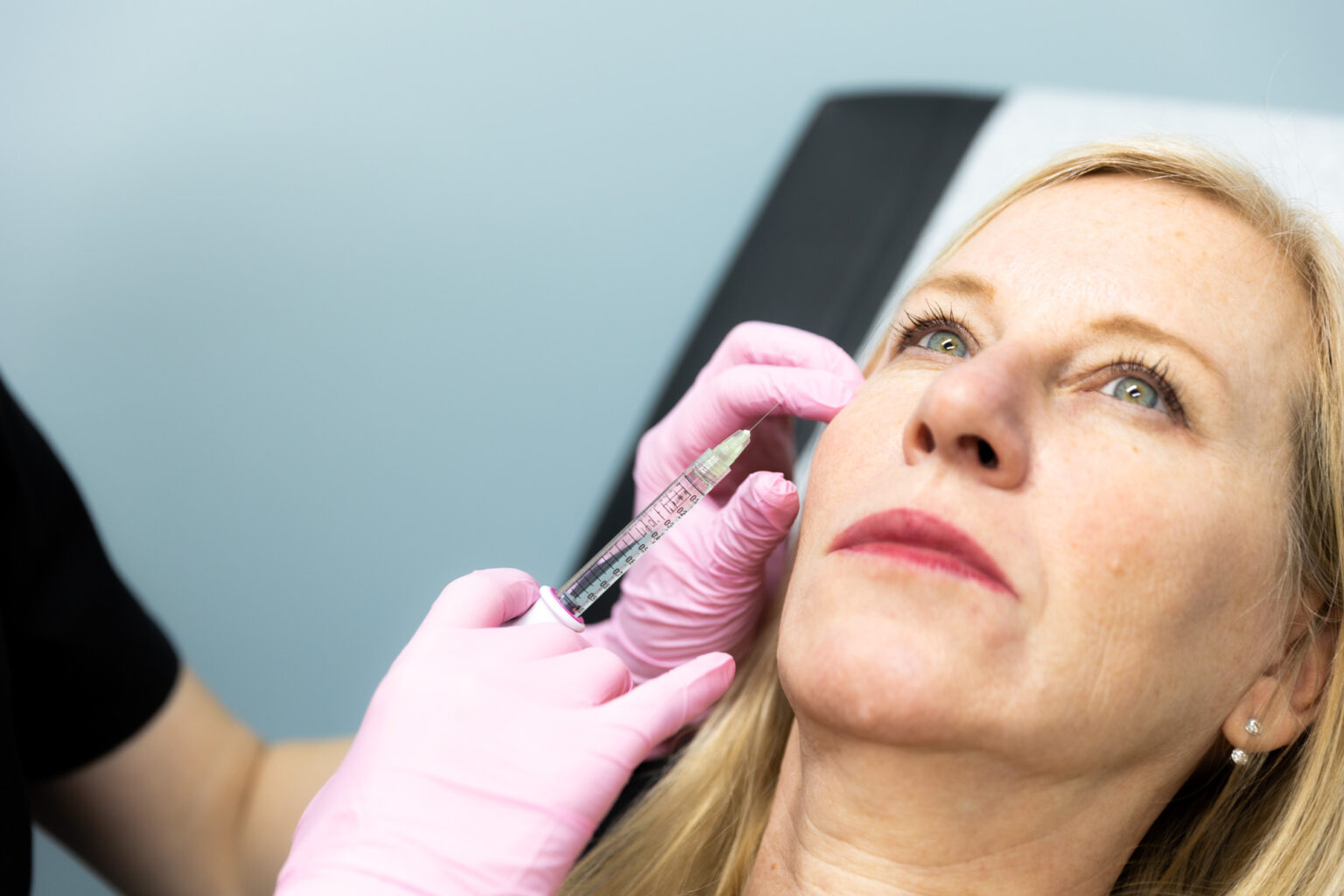 Facial Filler | Kansas City Skin and Cancer Center