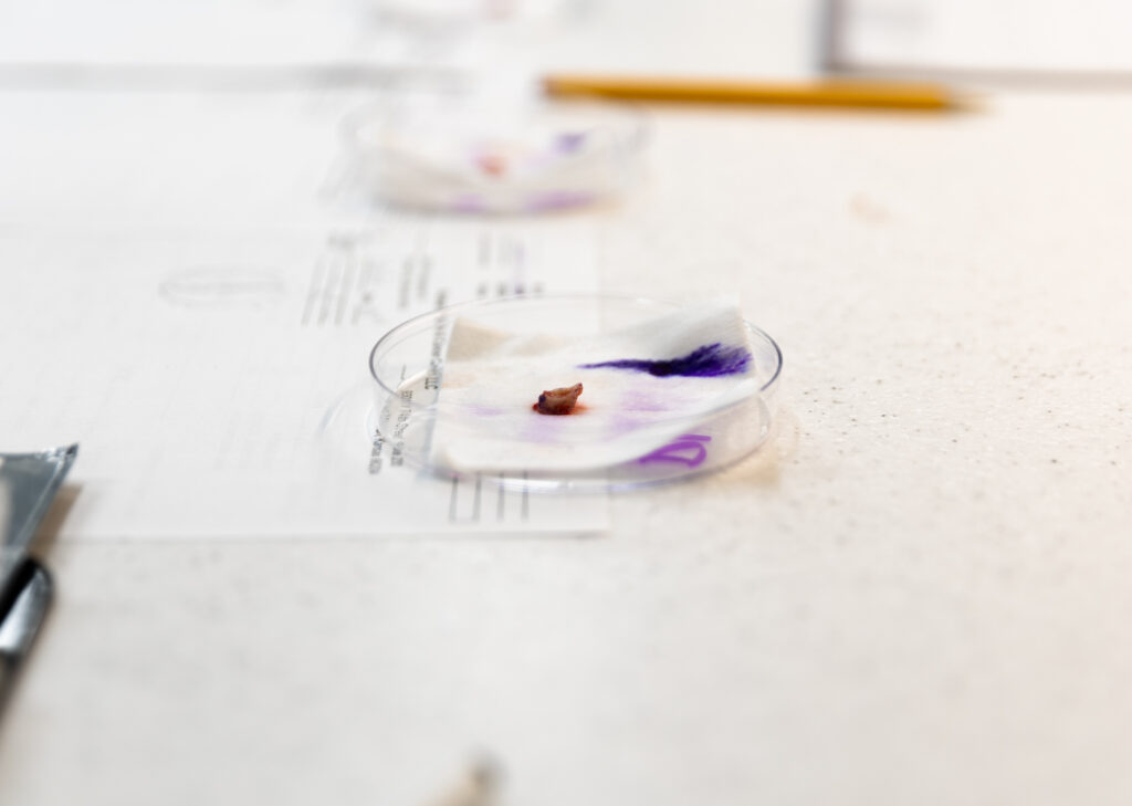 Medical Dermatology | Kansas City Skin and Cancer Center